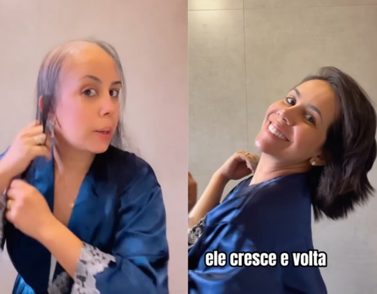 Administradora diagnosticada com câncer de mama mostra antes e depois ...