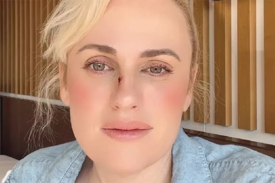 Rebel Wilson diz que sofreu guerra emocional por conflitos entre sentir ...