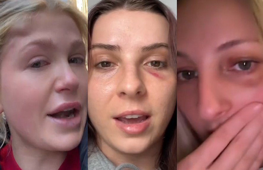 Influenciadora diz ter levado soco no rosto em meio a ataques ...