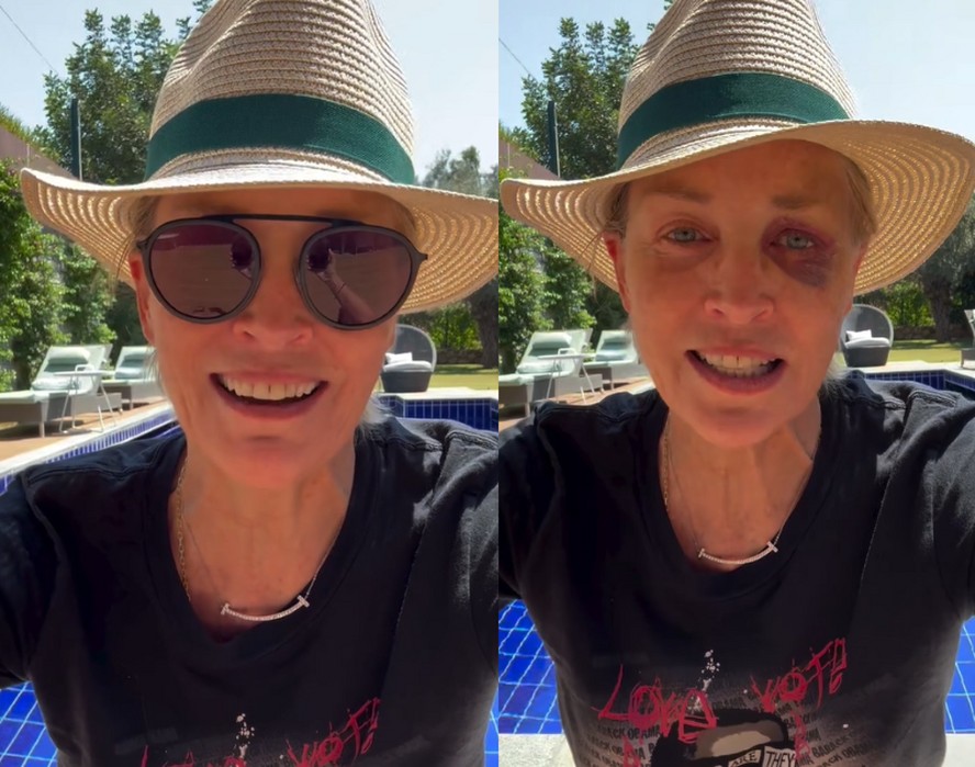 Sharon Stone explica motivo de estar com olho roxo: 'Vocês deveriam ter ...