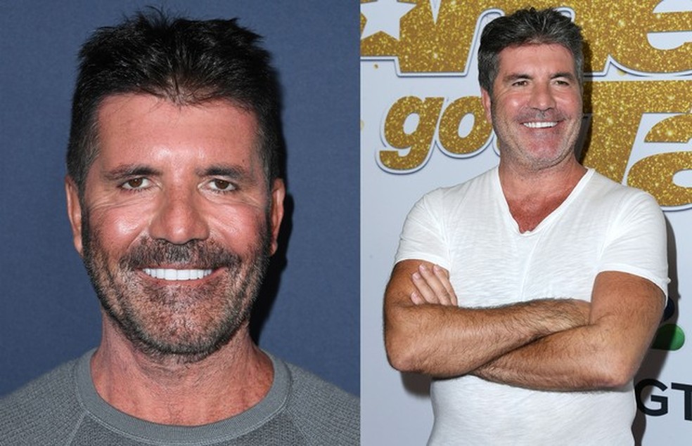 Simon Cowell surge diferente em evento e fãs opinam: 'Isso é botox ruim'