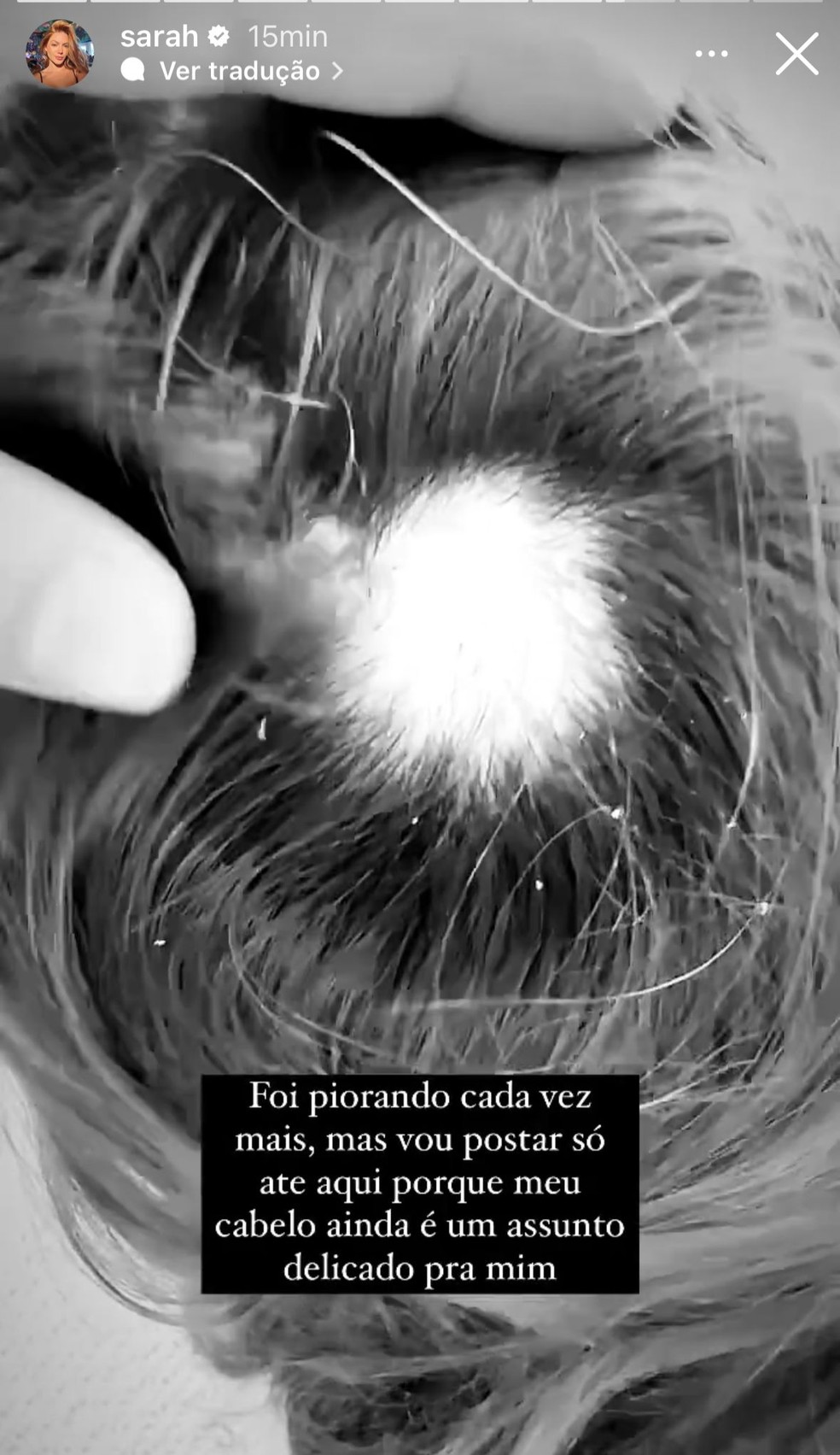 Sarah Poncio fala sobre depressão profunda: 'Meu cabelo caiu todo e ...