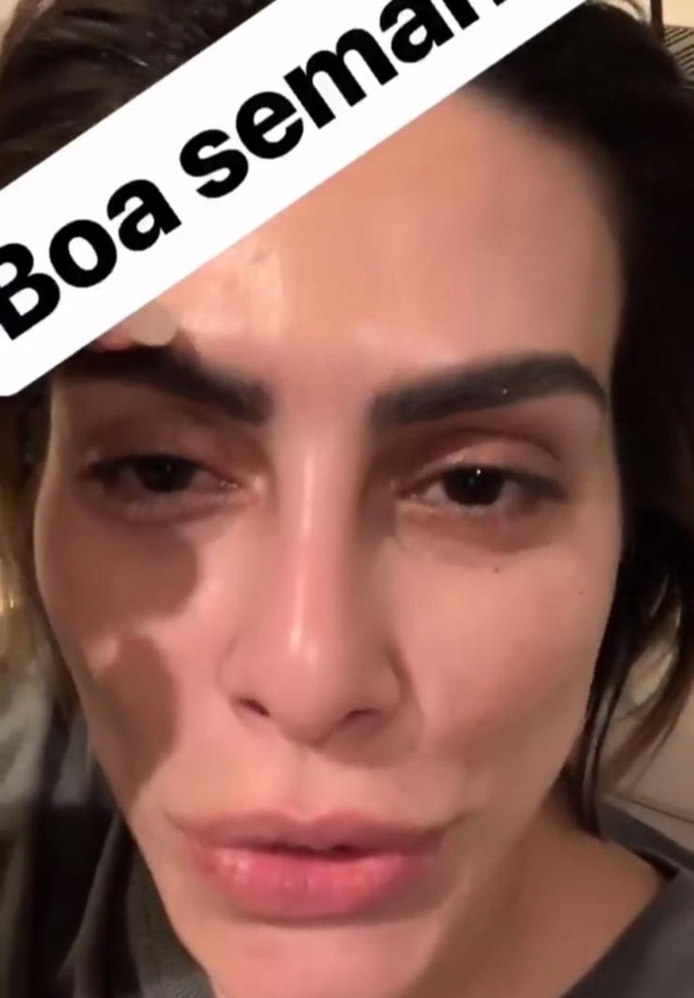 Cleo é 'devorada por mosquitos' e mostra resultado no Instagram