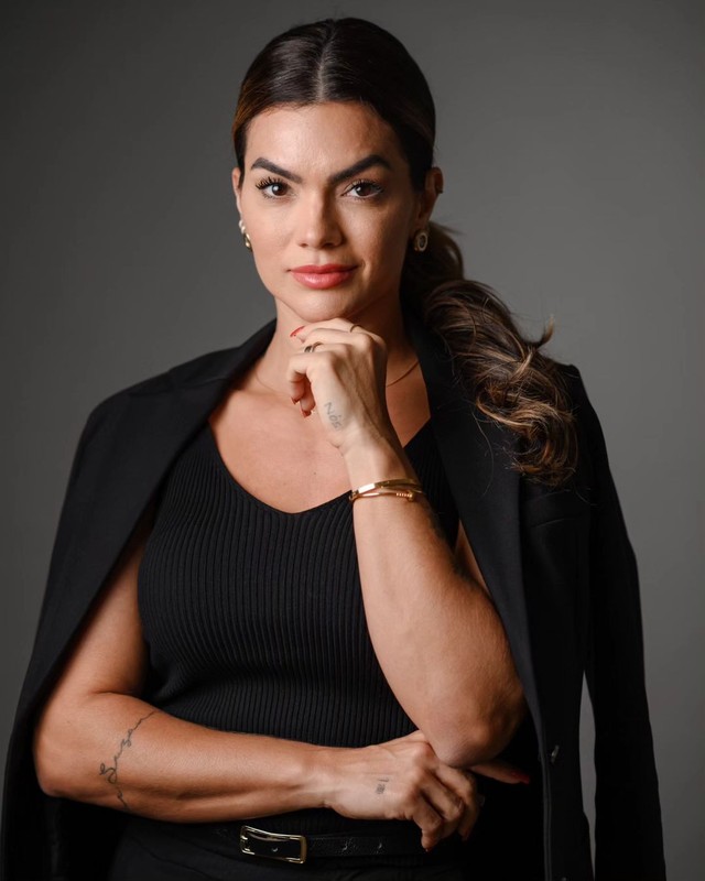 Kelly Key fala sobre psoríase, doença crônica que enfrenta: 'Vamos ...