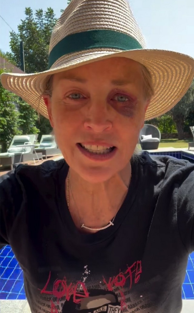 Sharon Stone explica motivo de estar com olho roxo: 'Vocês deveriam ter ...