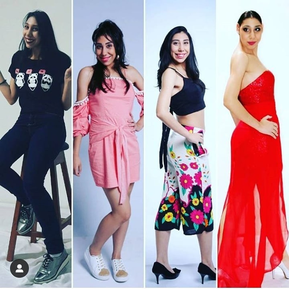 Como está a vida e carreira de Ana Victória Lago, a primeira modelo com ...