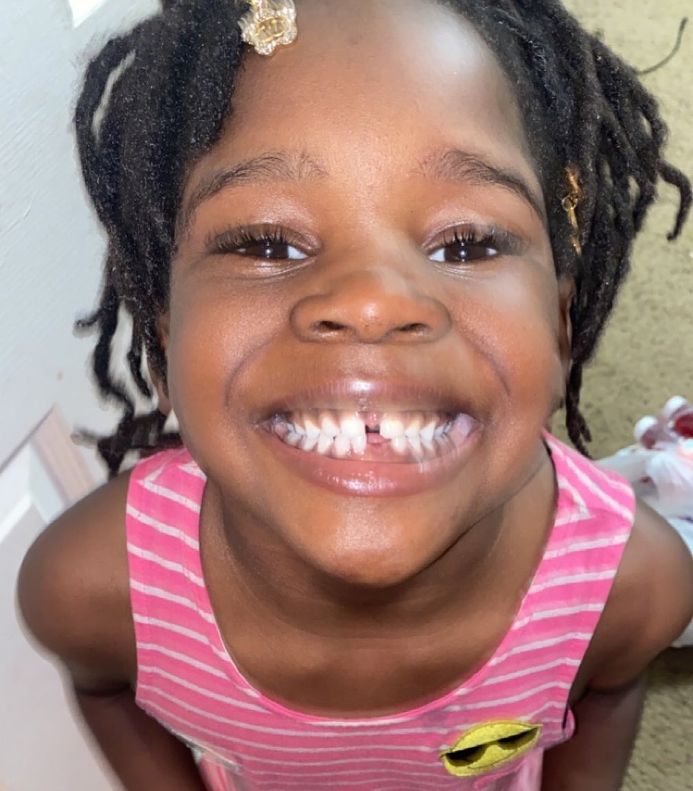 4 anos após viralizar dizendo que era feia, menina fala sobre ...