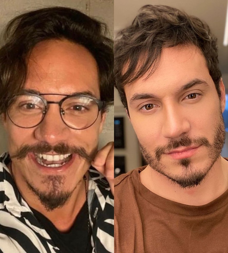 Eliezer exibe antes e depois de procedimentos estéticos