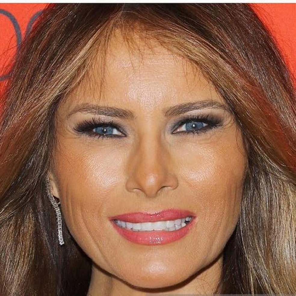 Fotos que revelam mudanças no rosto de Melania Trump dominam a web